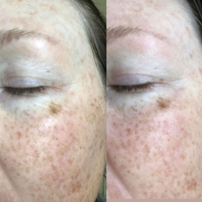 Essence de Jeunesse | Best Anti-Aging Face Cream by Lancolia